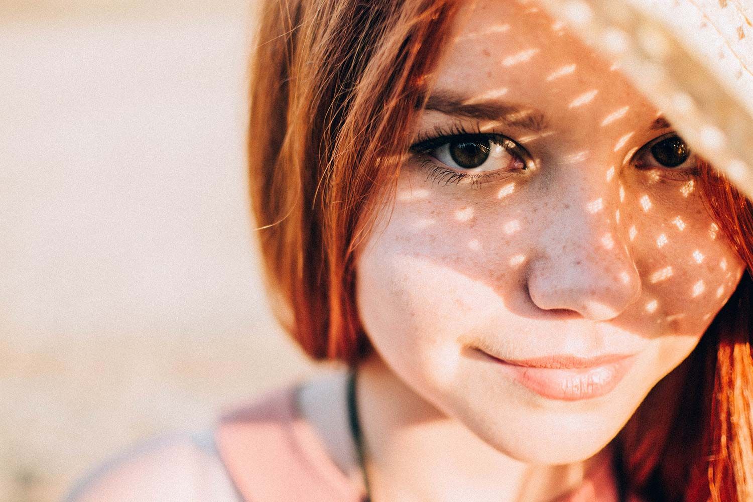 Mole Patrol | Skin Check Perth – Skin Check Perth